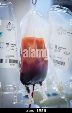 Les cellules souches du sang périphérique (PBSC) don par aphérèse ...