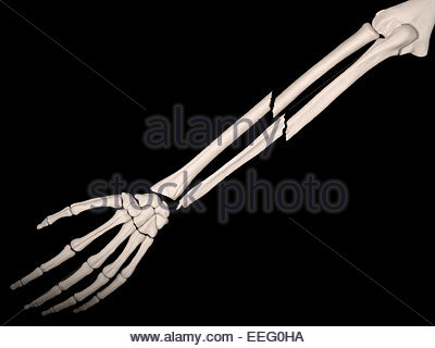 RADIUS et du cubitus Photo Stock - Alamy