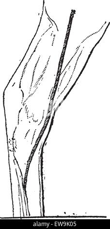 Vieille illustration gravée de grande veine saphène interne ou saphène ...