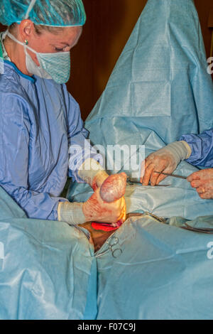 La chirurgie de l'orchidectomie Photo Stock - Alamy