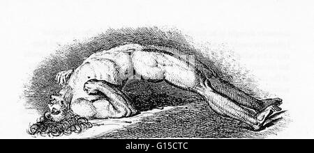 Illustration d'un grec homme souffrant Opisthotonus ('le spasme en ...