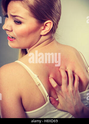 Problème de santé, maladies de la peau. Jeune femme de rayer son retour ...