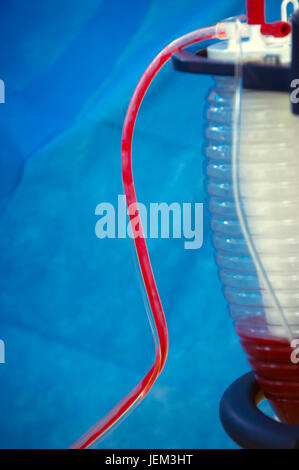 Cœur poumon artificiel de la pompe cardiaque Chirurgie cardiaque ...