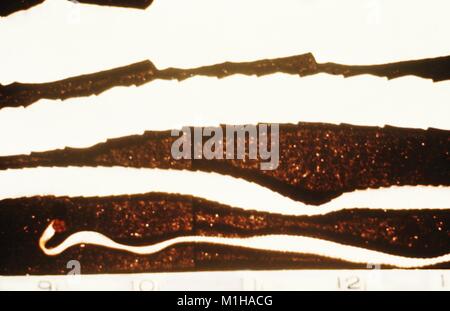 Une photographie de la Taenia ver Photo Stock - Alamy