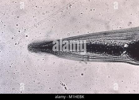 Micrograph Light d'une oxyurose Enterobius vermicularis (humain) L'oeuf ...