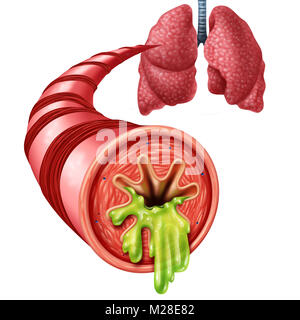 Anatomie de la bronchite, de mucus sécrété comme une bronchite comme un ...