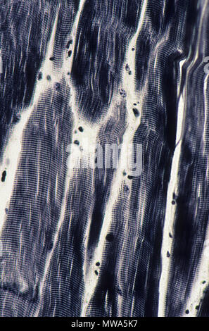 Micrographie à la lumière des cellules musculaires squelettiques. Les ...
