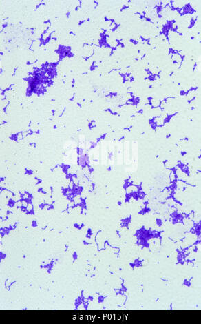 Les bactéries Streptococcus. Micrograph Light de gramme-souillée des ...