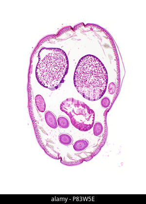 Coupe transversale d'ascaris Photo Stock - Alamy