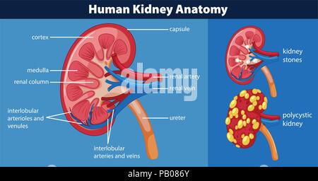 Schéma de l'anatomie humaine avec des pierres de rein illustration ...