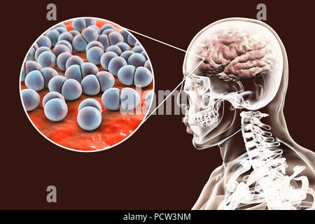 Streptococcus pneumoniae, ou le pneumocoque, est une bactérie gram ...