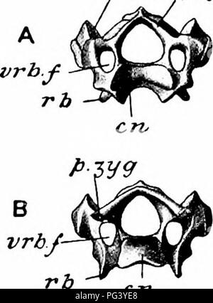 Les côtes cervicales et le processus transversal de la vertèbre ...