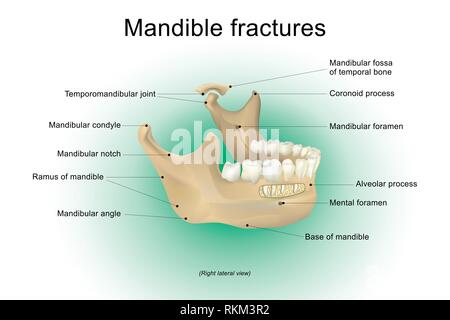 Anatomie dentaire des dents et gencives humaine mandibulaire, la vue x-ray. Dent précise ...