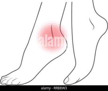 Concept douloureux de pied de jambe avec douleur talon cercle rouge ...