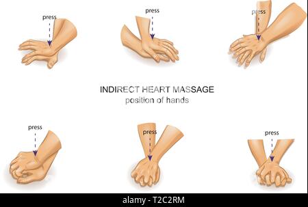 Position anatomique du cœur Banque D'Images, Photo Stock: 353179976 - Alamy