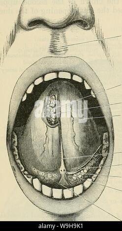 Illustration de la langue et du plancher de la bouche des muscles ...