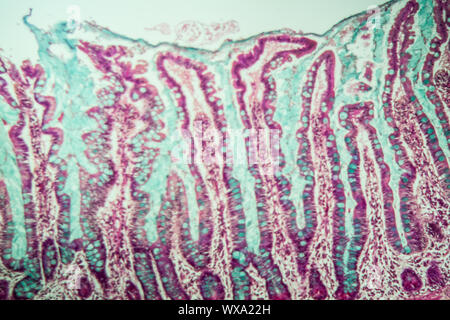 L'intestin grêle avec des villosités intestinales sous le microscope ...