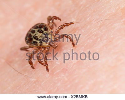 Tiques Dermacentor reticulatus (marais), homme sur la peau humaine ...