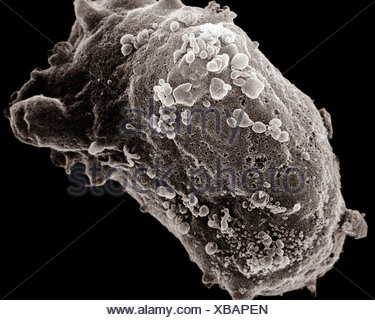 Un microscope électronique à l'image d'un lymphocyte (globule blanc ...