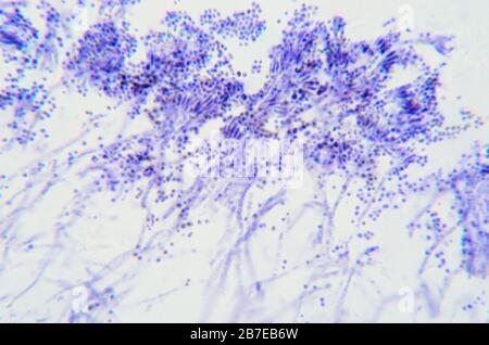 Spore di muffa sotto il microscopio luminoso, stampo a buccia d'arancia ...