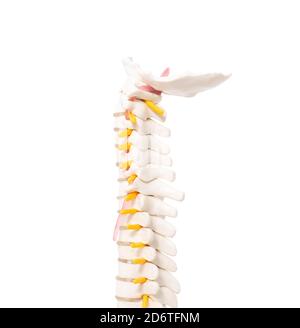 Colonna cervicale e toracica su sfondo bianco. Ernia intervertebrale ...