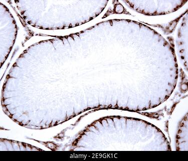 Microscopia a luce di un tubulo seminifero nel testicolo mostra piena ...