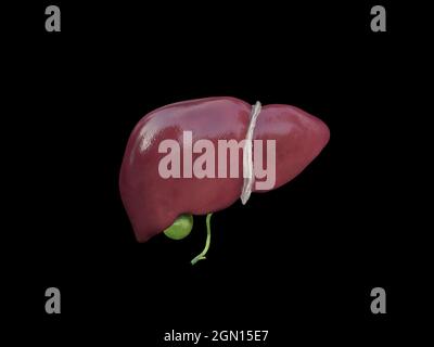 Cancro del fegato dell'organo digestivo, epatite cirrosi tumore maligno ...