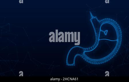 Endoscopia gastrica. Endoscopio nello stomaco attraverso esofago ...
