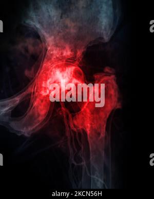 Scansione TC dell'osso pelvico e dell'articolazione dell'anca rendering ...