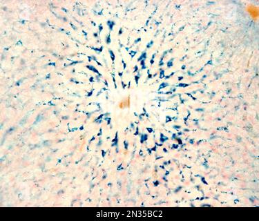 Le cellule di Kupffer sono macrofagi del fegato. Il ferro colloidale ...