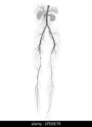 Anatomia umana dell'arteria femorale Foto stock - Alamy