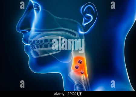 Proiezione radiografica laterale o del profilo della laringofaringe o ...
