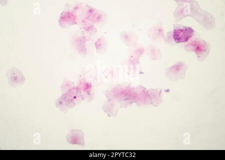 Striscio buccale. Micrografia di luce di un smear buccale. Le cellule ...