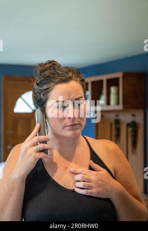 Il carcinoma a cellule basali (BCC), o ulcera di roditore, su 86 anno ...