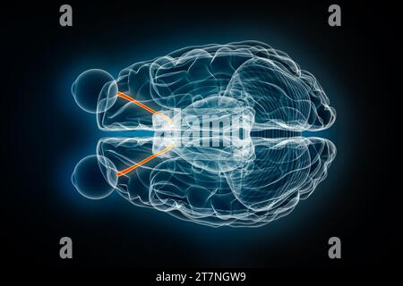 Vista ravvicinata del profilo radiologico oculare e del nervo ottico o ...