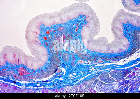 Esofago o esofago umano che mostra epitelio squamoso stratificato, vasi ...
