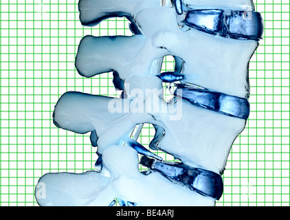 Primo piano della colonna vertebrale umana che mostra le vertebre ...