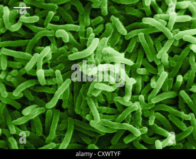Micrografia al microscopio elettronico a scansione (SEM) di Vibrio ...