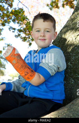 Ragazzo con braccio rotto, gesso sul braccio come terapia. Close up di ...
