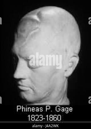 Phineas Gage. Fotografia di Phineas P. Gage (1823–1860), un caposquadra ...