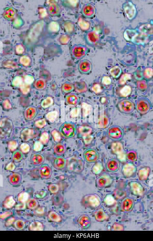 Microscopio elettronico a trasmissione (TEM) del virus del morbillo ...