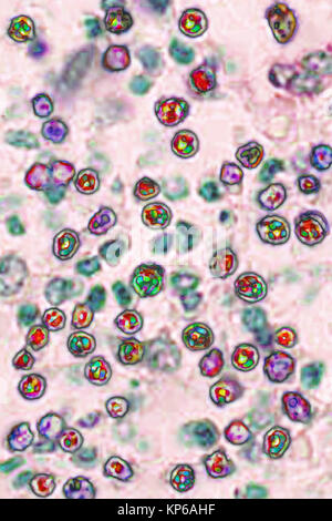 Microscopio elettronico a trasmissione (TEM) del virus del morbillo ...