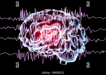Il cervello e le onde cerebrali di epilessia, illustrazione del ...