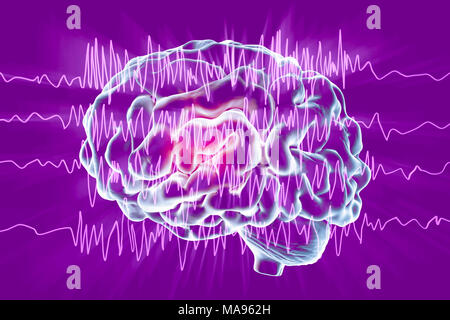 Il cervello e le onde cerebrali di epilessia, illustrazione del ...