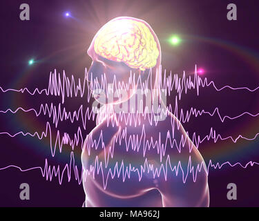 Il cervello e le onde cerebrali di epilessia, illustrazione del ...
